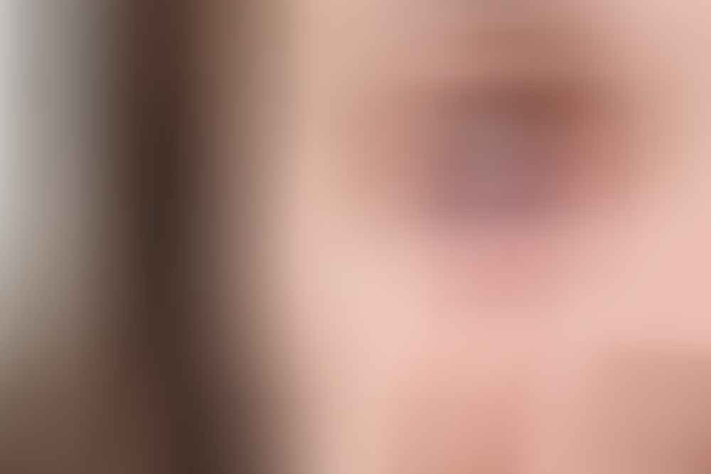 Essential Post-Operative Care for Retina Surgery Recovery - Specialty ...