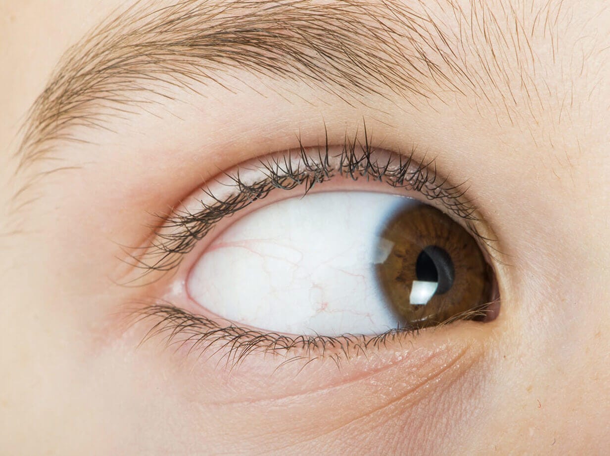 Horizontal Gaze Nystagmus: A Complete Guide Horizontal Gaze Nystagmus: A Complete Guide