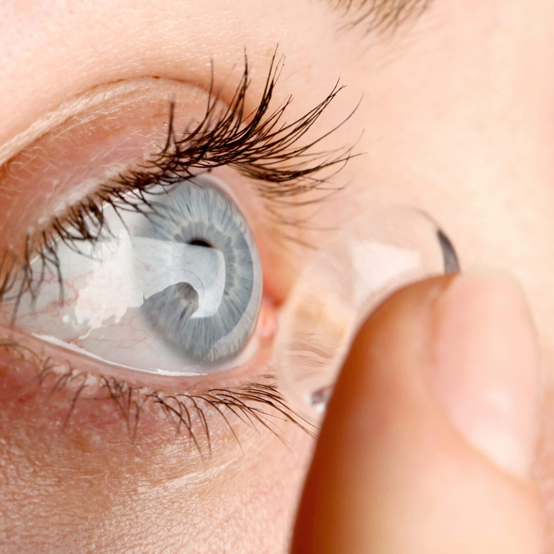 Best IOL Lenses for Cataract Surgery to Reduce Glare and Halos ...
