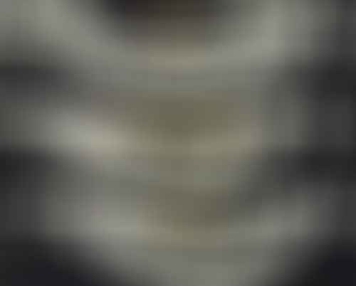 How to Perform Blinking Exercises for Dry Eye Relief - Specialty Vision