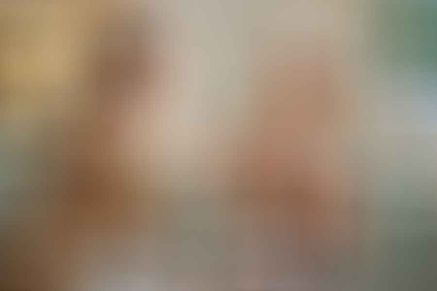 Focal Laser Treatment for Retinal Health - Preserve Your Vision ...