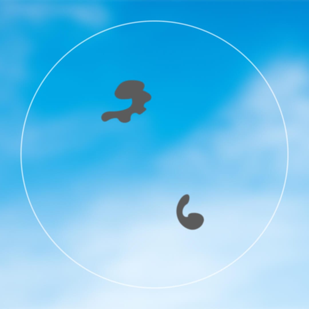 Blue Field Entoptic Phenomenon