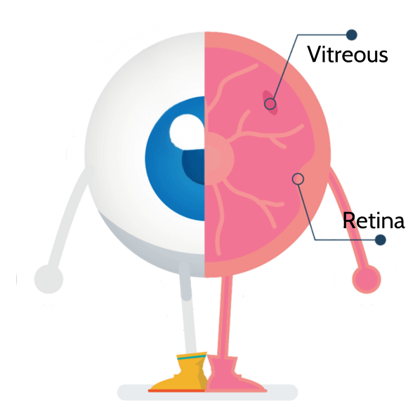 Endolaser: Advanced Treatment in Retinal Surgery - Specialty Vision