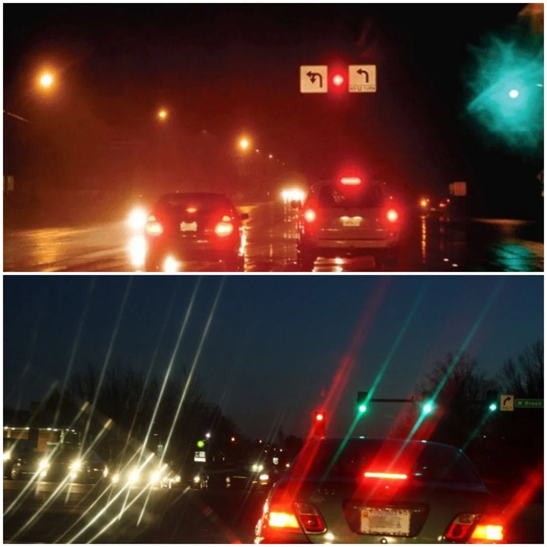 Understanding Astigmatism and Dry Eyes - Specialty Vision