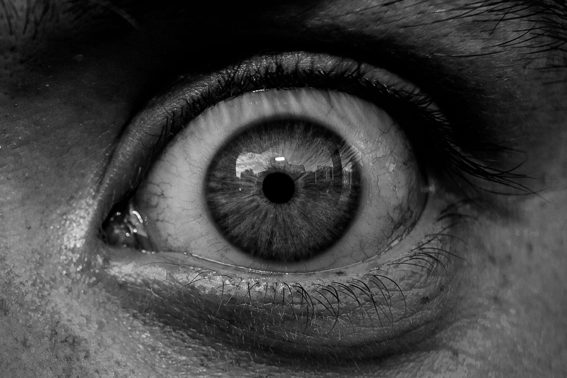 Laser Retinopexy: Effective Treatment for Retinal Tears - Specialty Vision